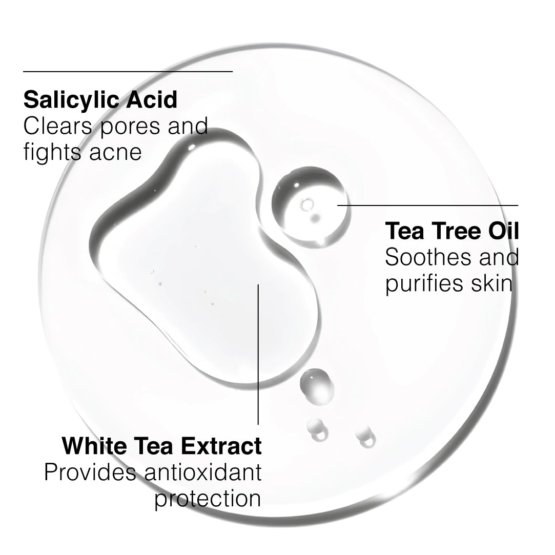 Acne Plus Face Wash – Wisdom Pharma